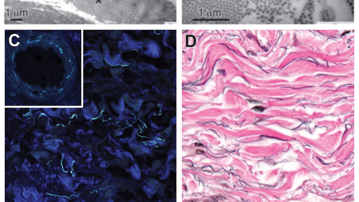 Human Tissue Cells Crafting A High Def Human Tissue Atlas | Department