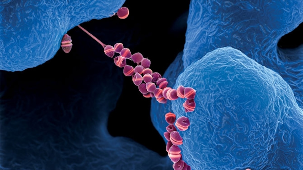 Grúpa Streptococcus A