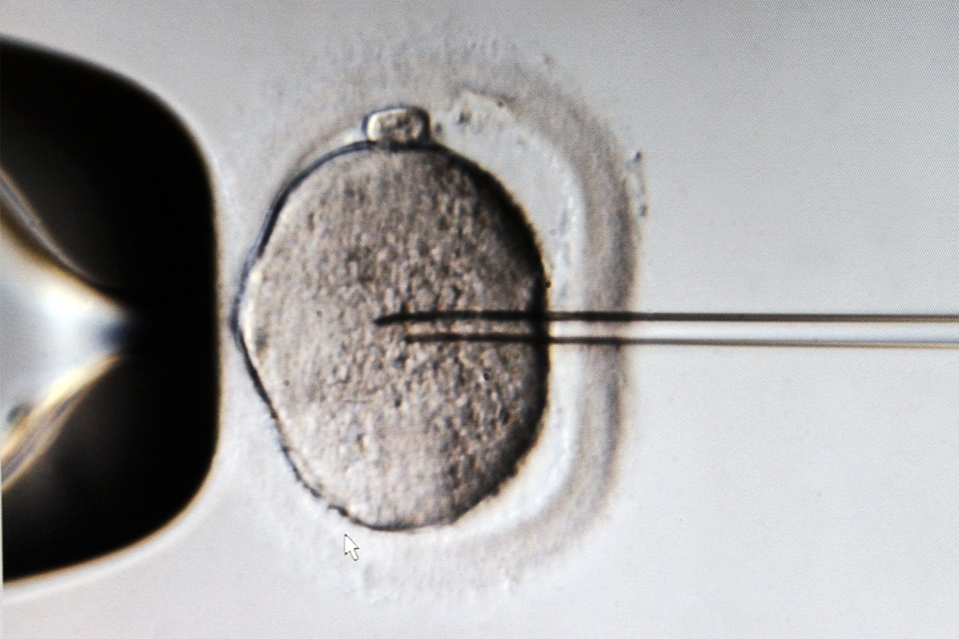 Human Body Upgrade Photos - National Geographic