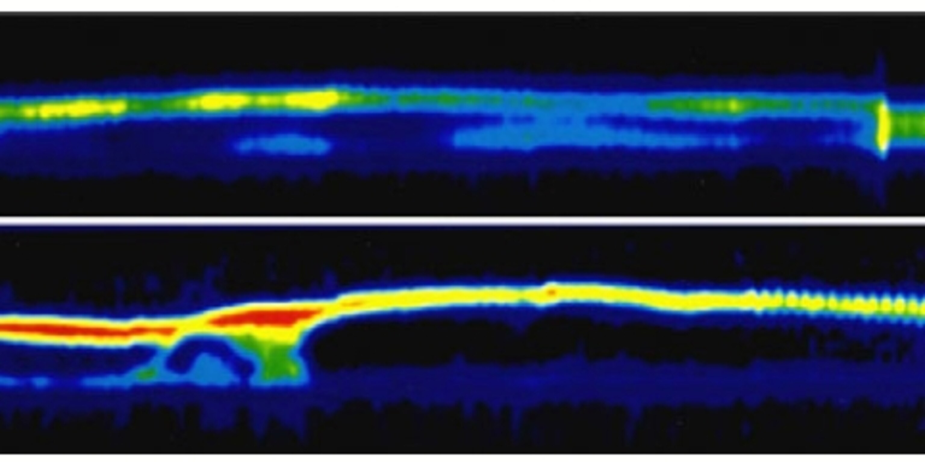 Expanding Guts in Pythons and People