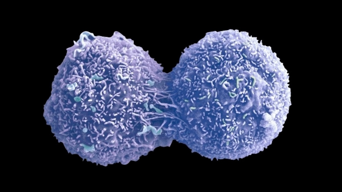 The Tumor Within A Tumor | National Geographic