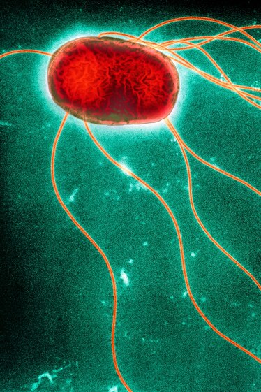 Salmonella can be deadly. Here’s how to protect yourself from it.