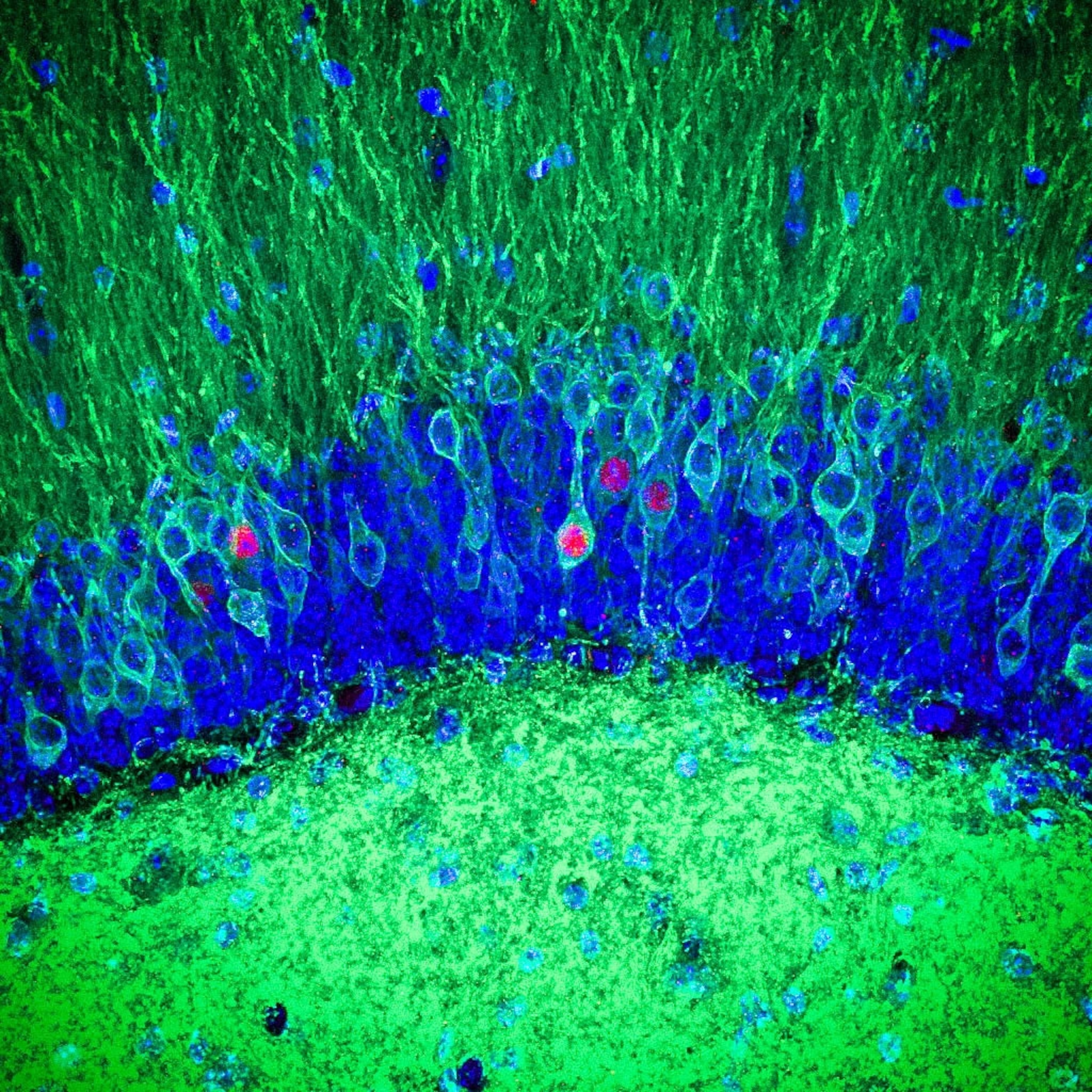 Memories Can Be Altered in Mice. Are Humans Next?
