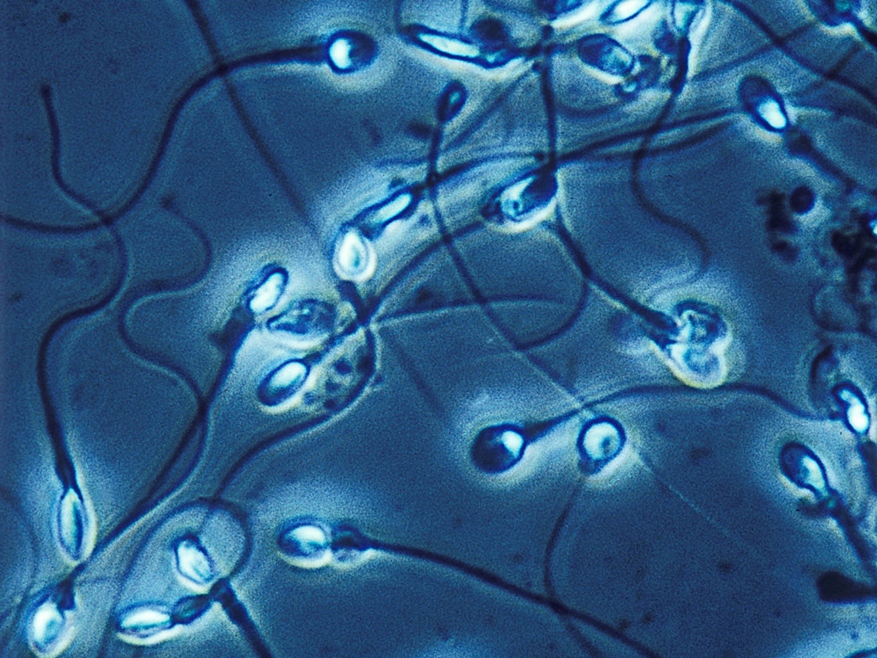 Deep-Voiced Men Have Lower Sperm Counts, Study Says