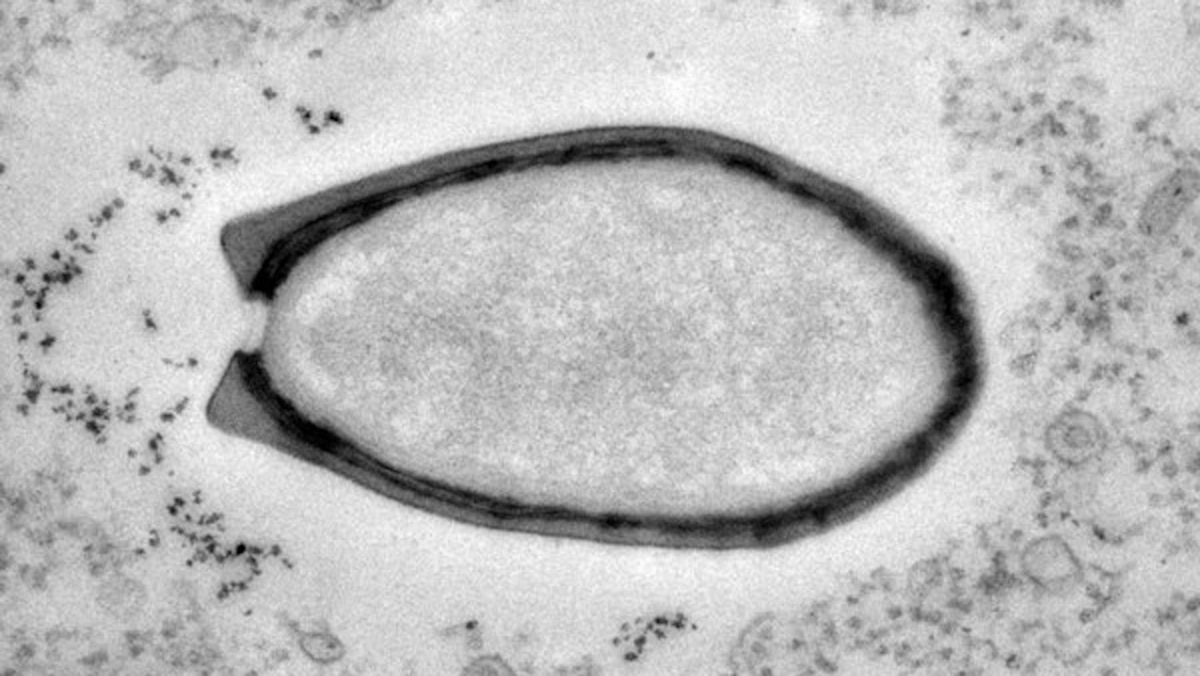 Gigantic Giant Viruses and the Endless Viral Frontier | National Geographic