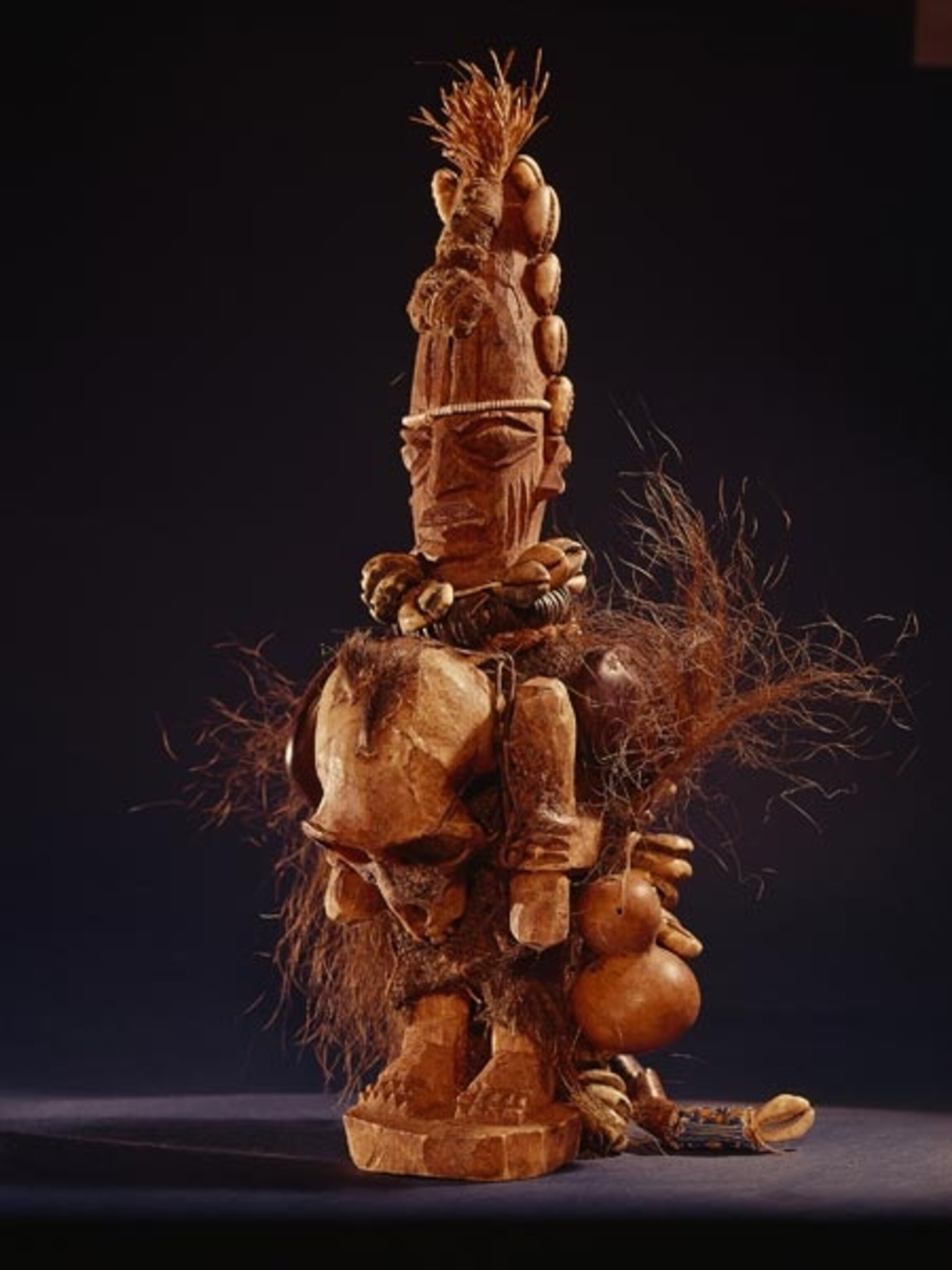 'Worst-Ever' Case of Super-Gonorrhea Detected in U.K. Man