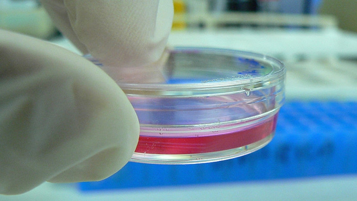 Your Disease In A Dish | National Geographic