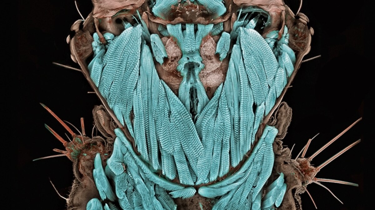 Pictures: Best Micro-Photos of 2011 | National Geographic
