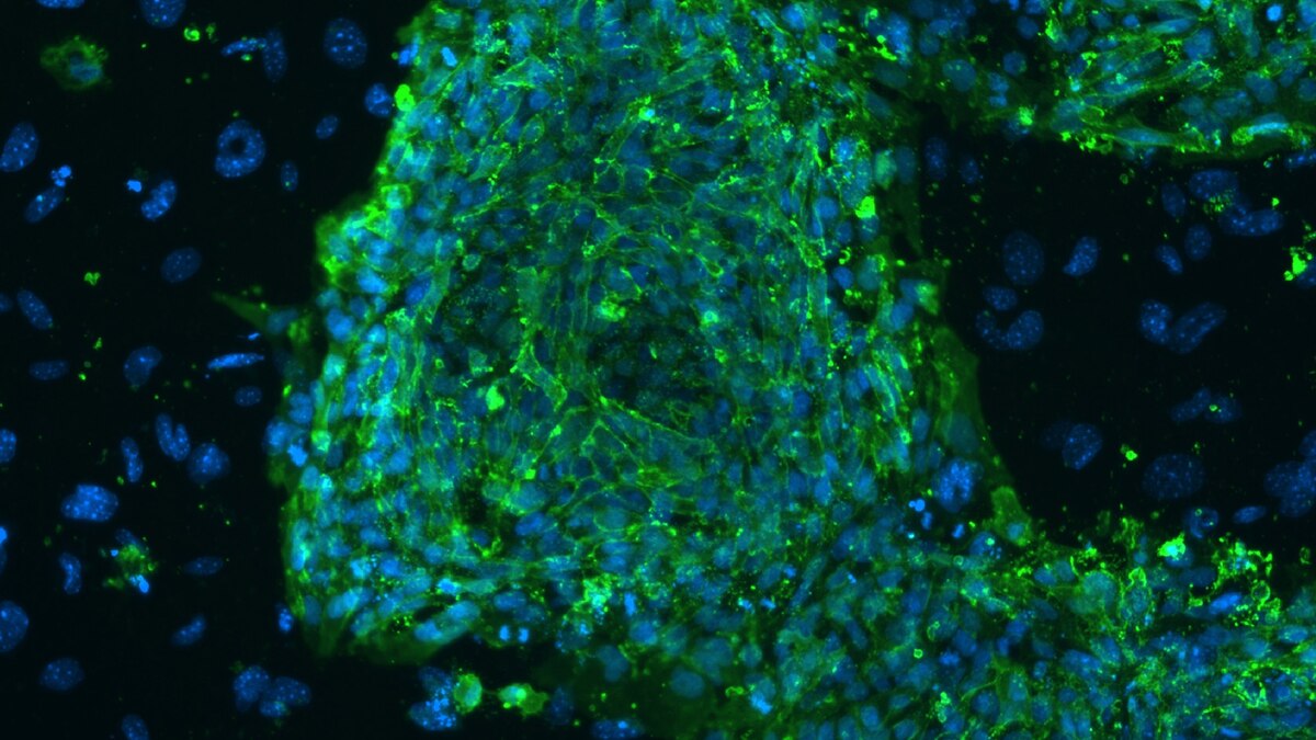 Ancient Virus DNA Gives Stem Cells the Power to Transform | National ...