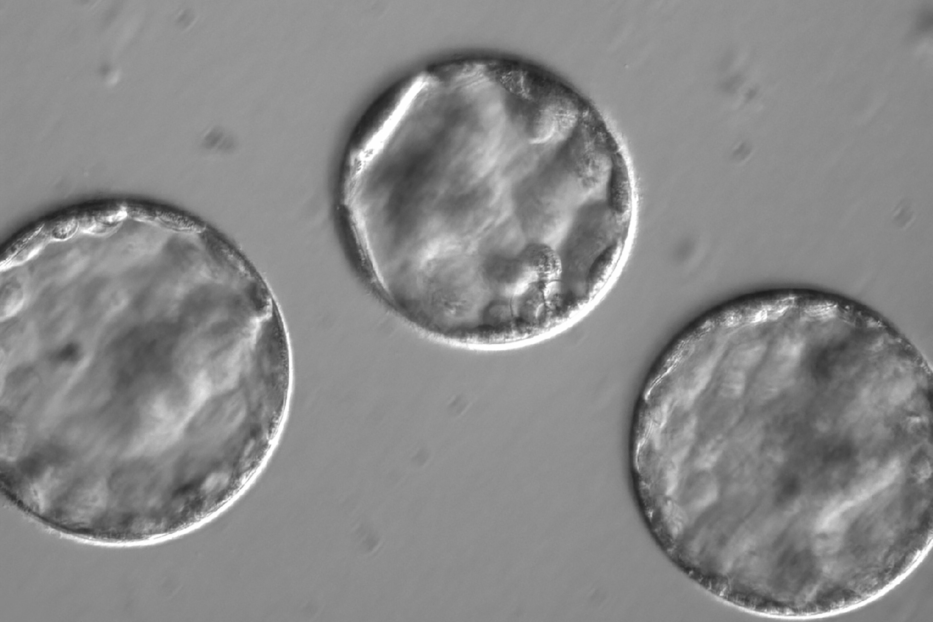 First Human Embryos 'Edited' in U.S.—Get the Facts