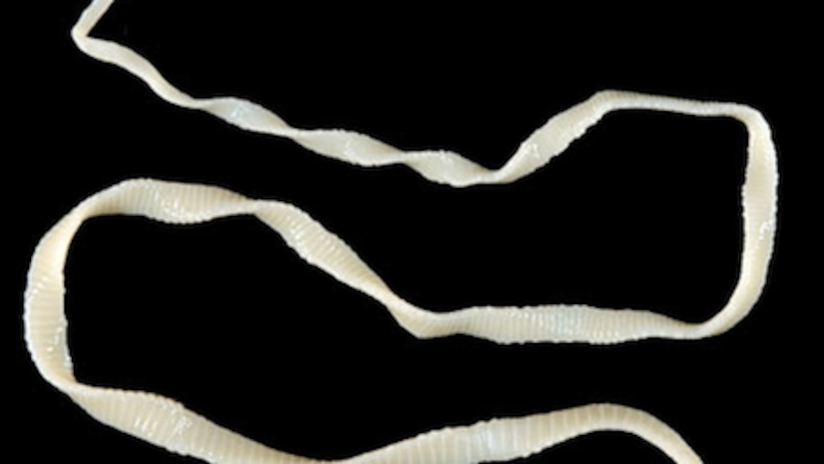 Why Madagascar's Tapeworms Matter–To You | National Geographic