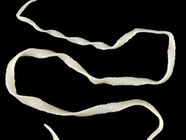 Tapeworm Infection Contagious At Ava Oshaughnessy Blog