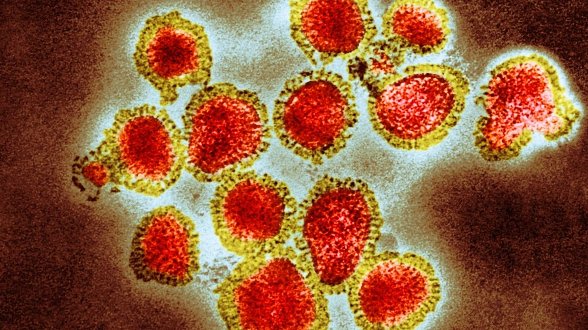 Experts predict this year's flu season to be worse than usual—here's why | National Geographic