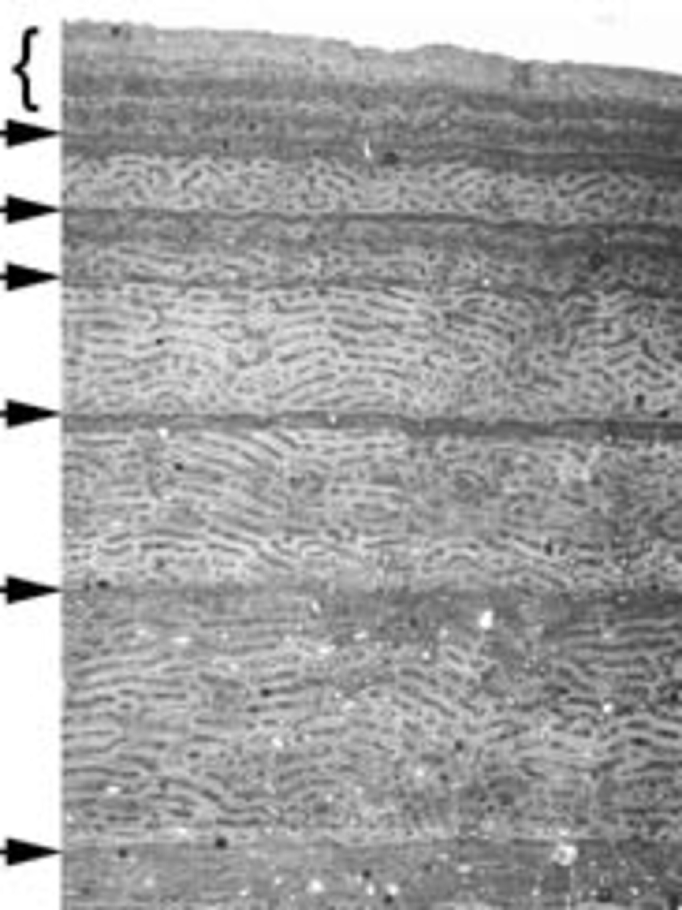 Duck-billed dinosaur defended itself by outgrowing predators