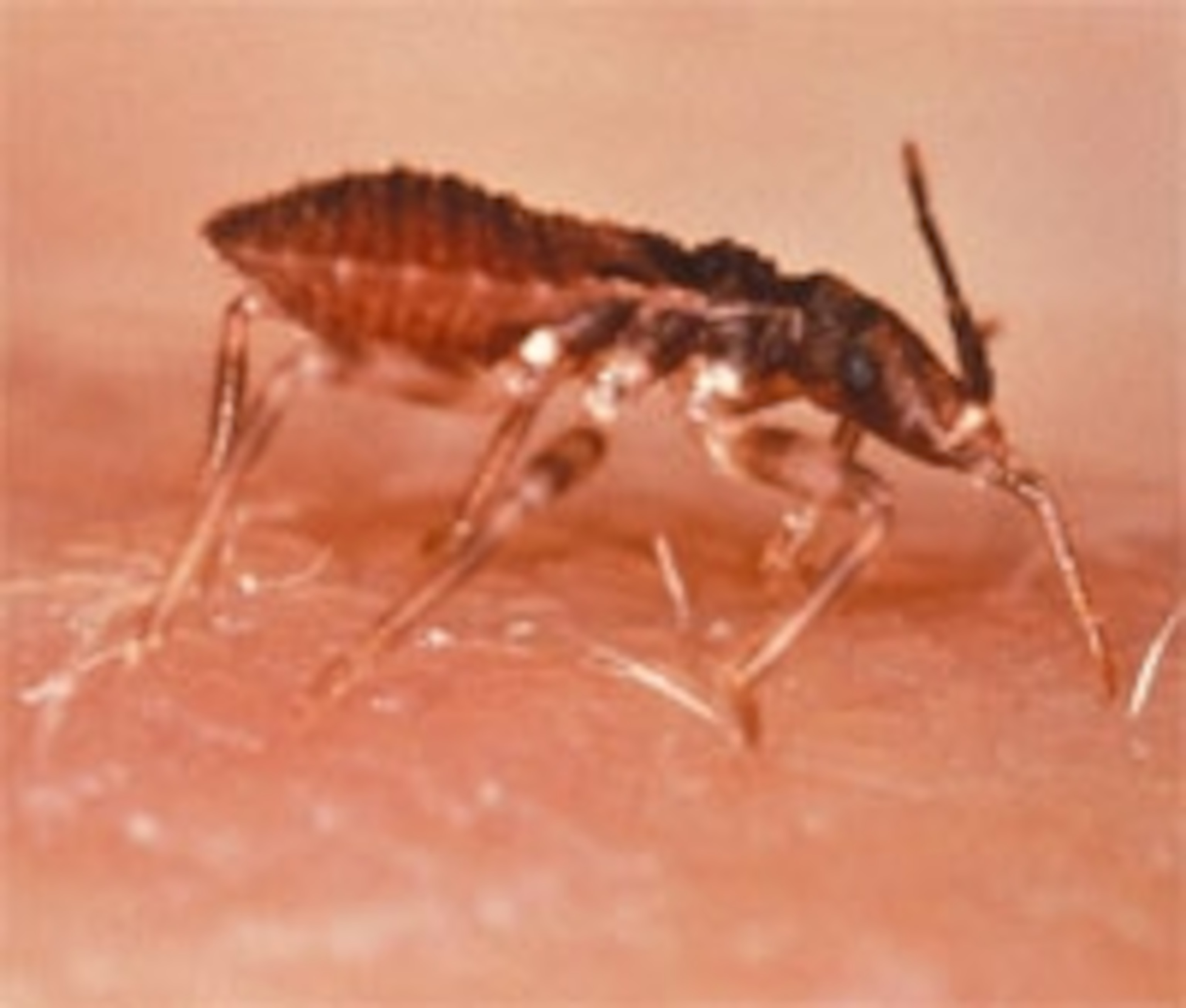 Genes from Chagas parasite can transfer to humans and be passed on to ...