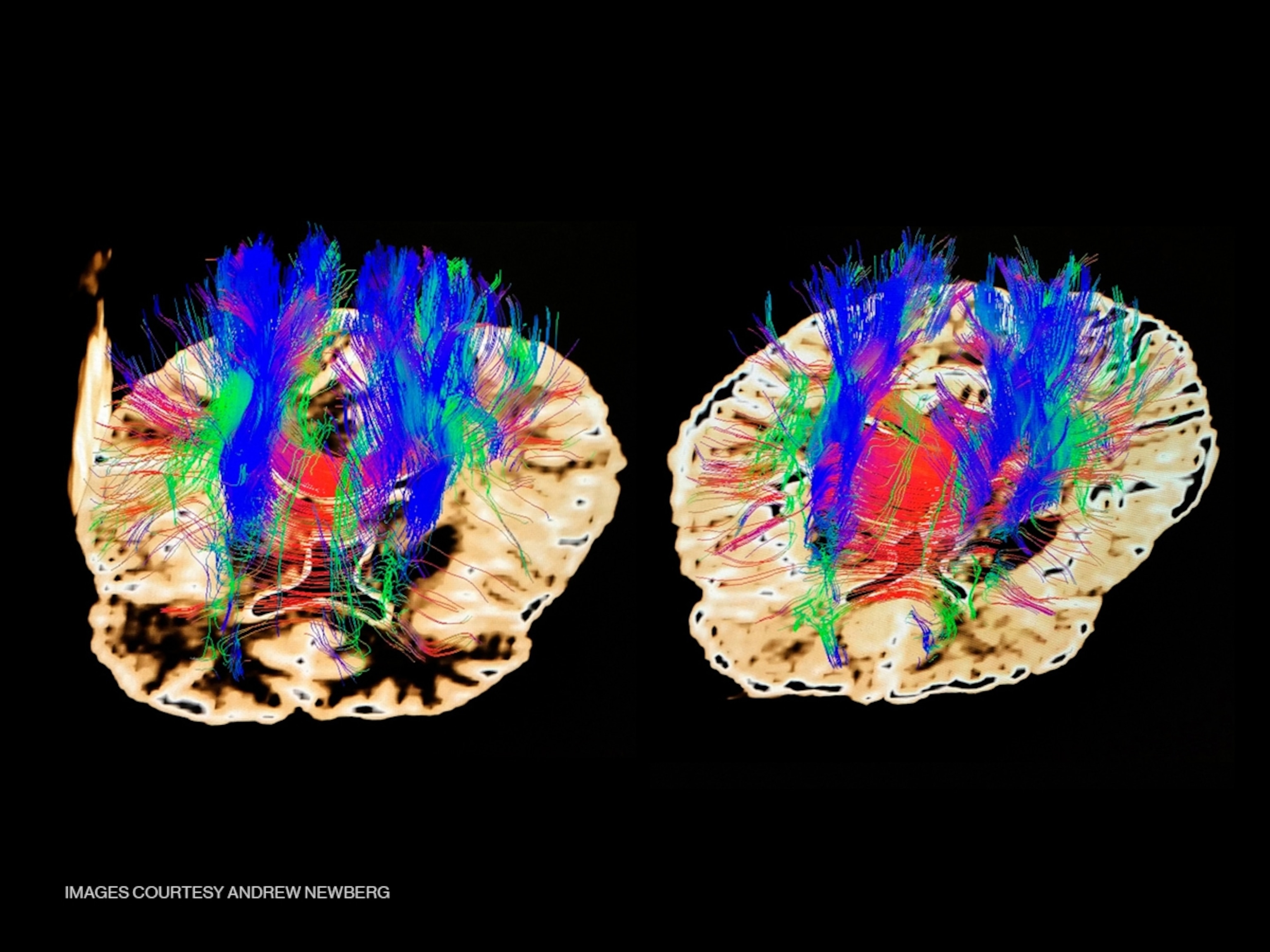 What Makes a Genius?