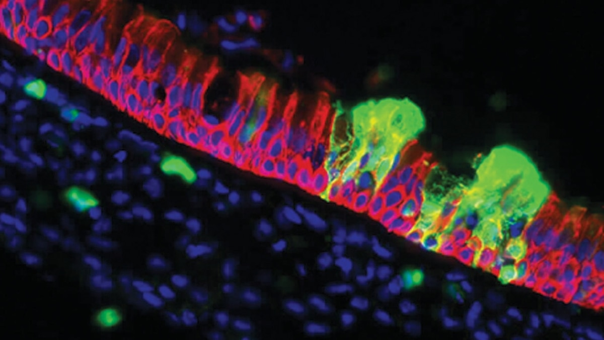 How The Measles Virus Became A Master of Contagion | National Geographic