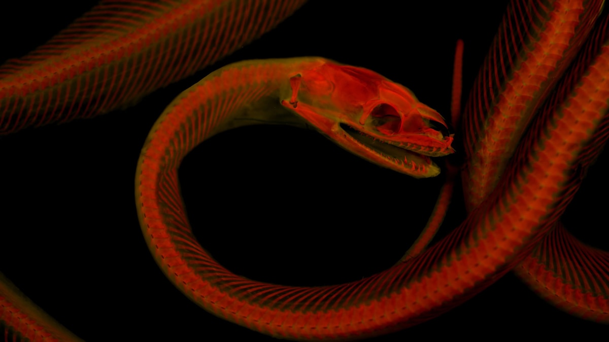 Skeleton photos are getting a boost with the help of gelatin | National ...