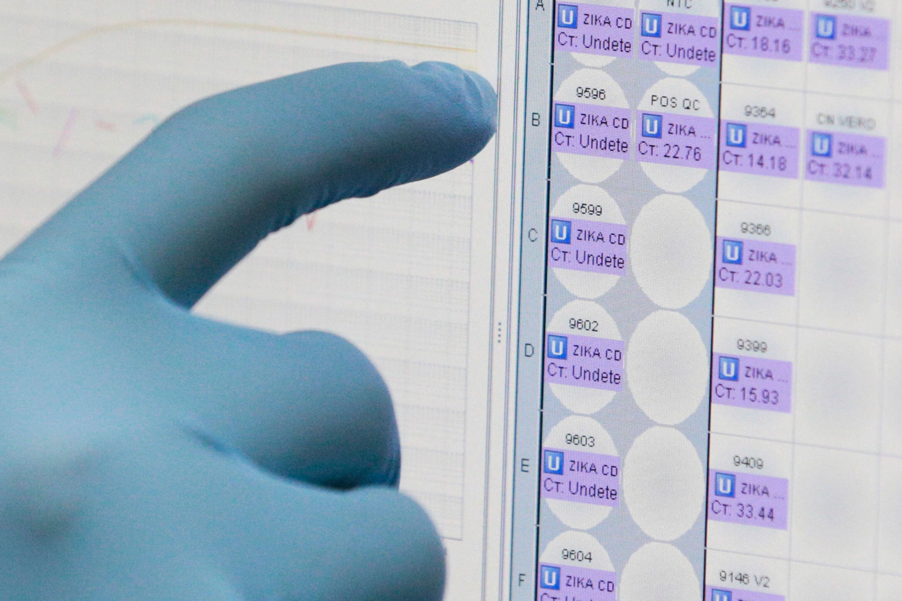 It's Official: Zika Is a Sexually Transmitted Infection