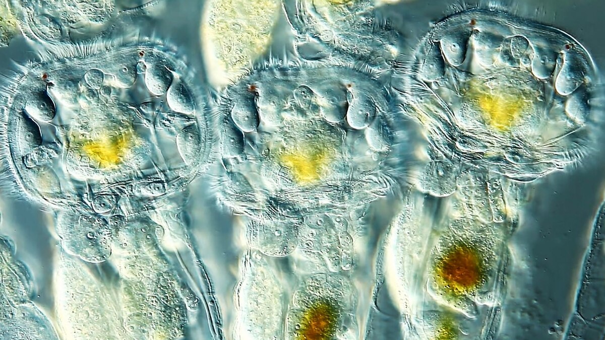 Pictures: Capturing the Beauty of Life Through a Microscope | National ...