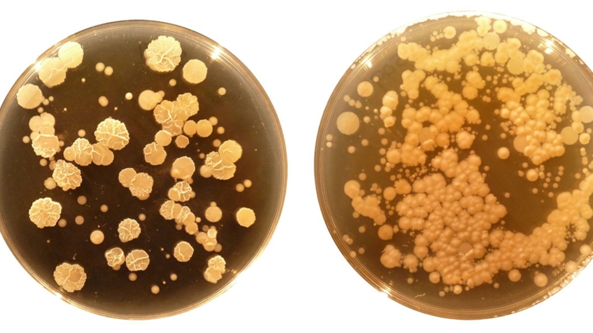 What lives in your belly button? A 'rainforest' of species | National ...