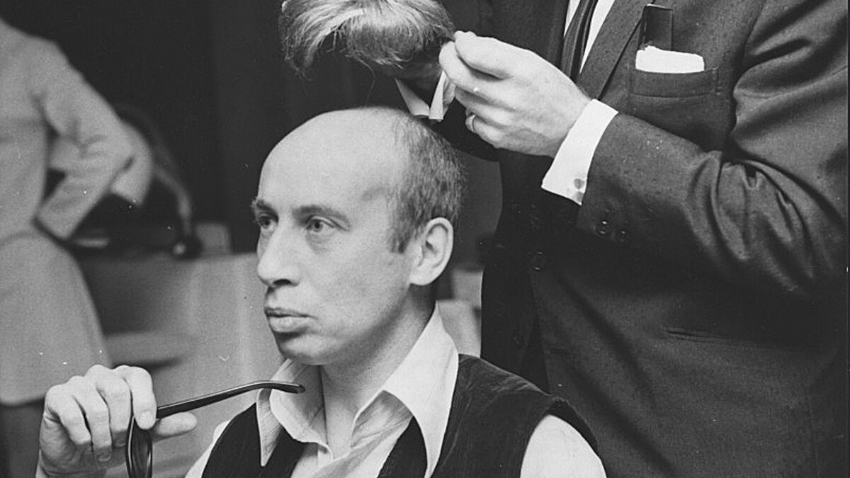 New Baldness Cure Joins History of Hair-Loss Fixes | National Geographic