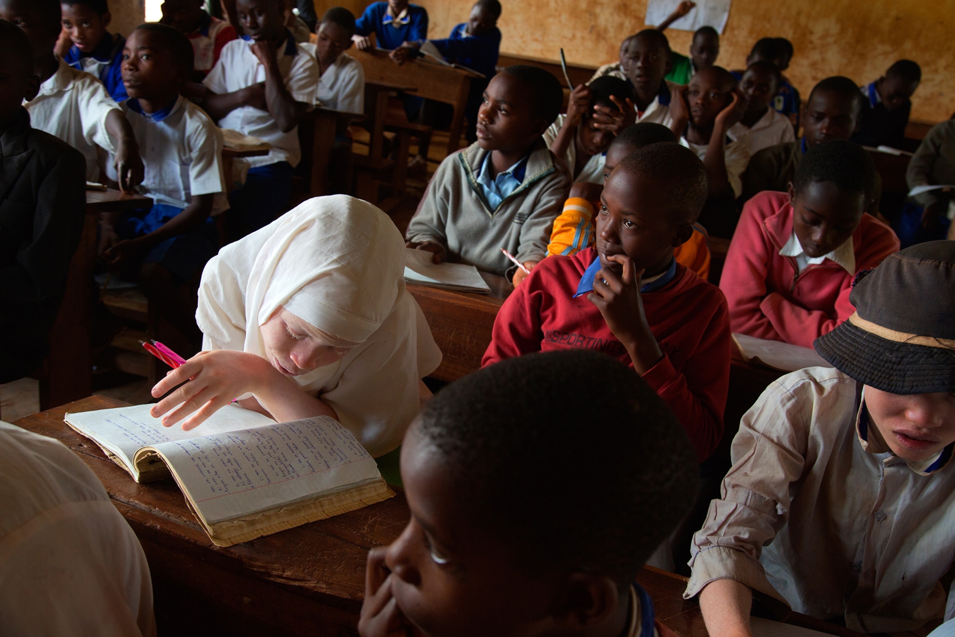 Awareness Day Seeks to End Abuses Against Albinos