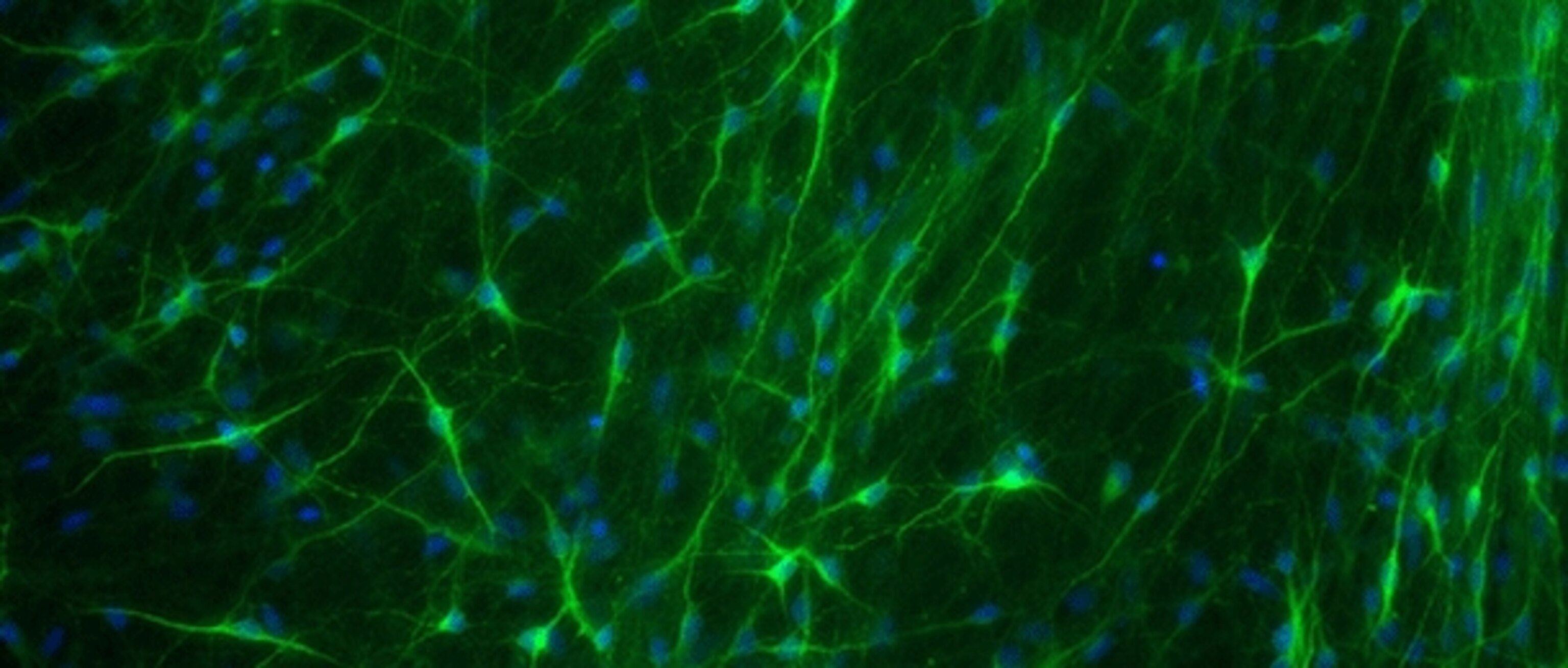 New neurons buffer the brains of mice against stress and depressive ...