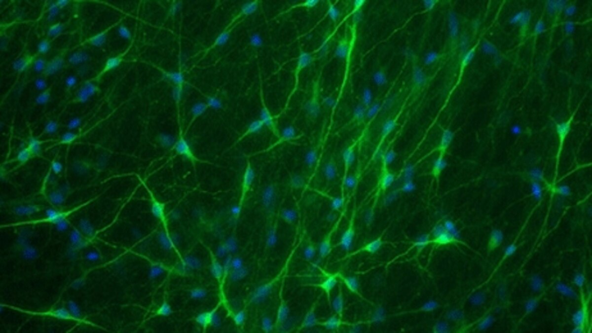 New neurons buffer the brains of mice against stress and depressive ...