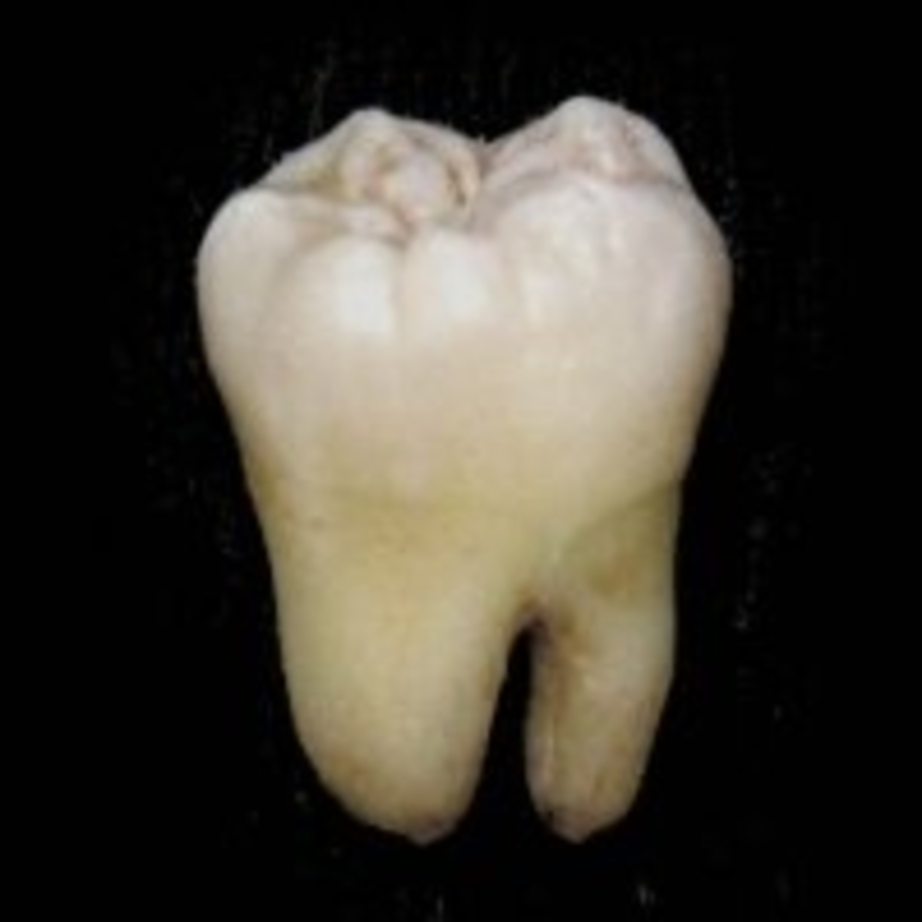 Tiny built-in cracks stop teeth from shattering