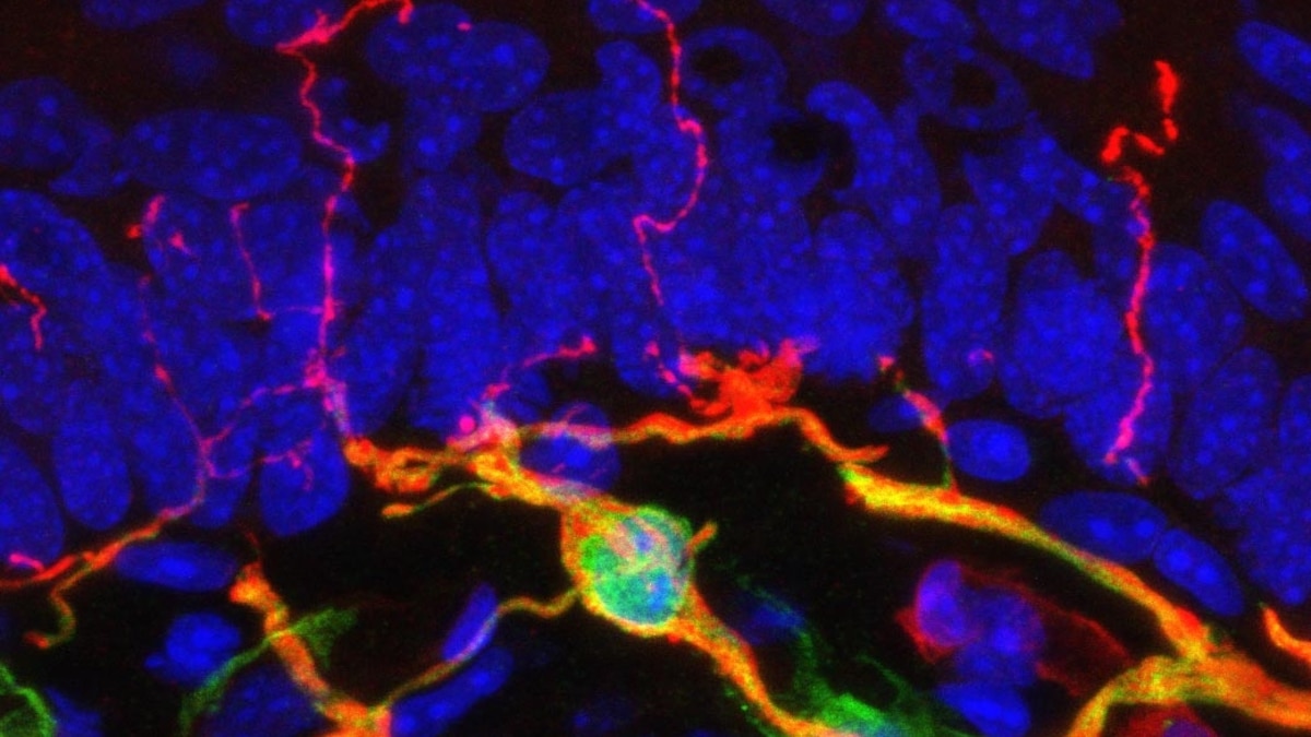 Newly discovered organ may be lurking under your skin | National Geographic