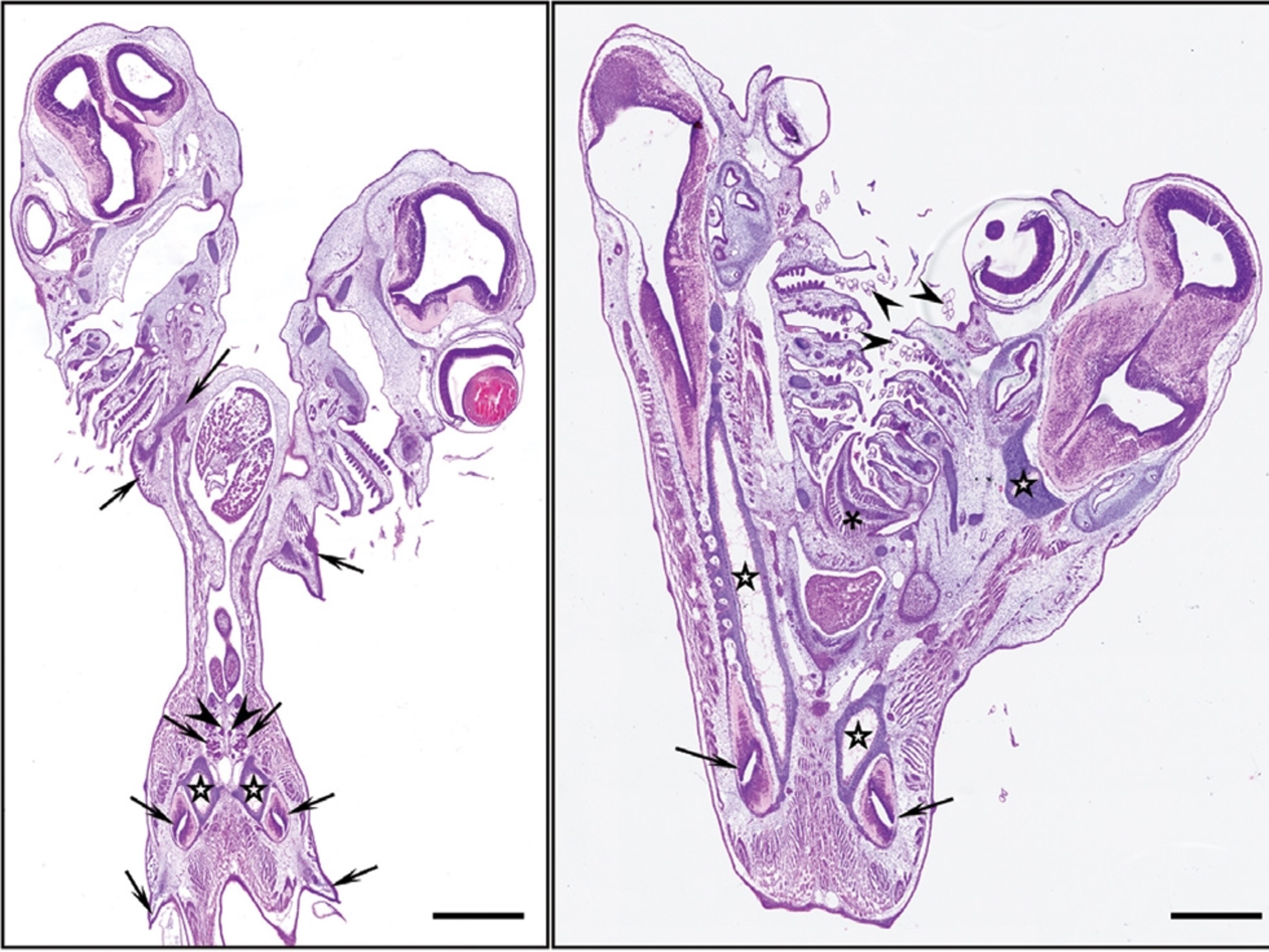 Two-Headed Shark Is First of Its Kind
