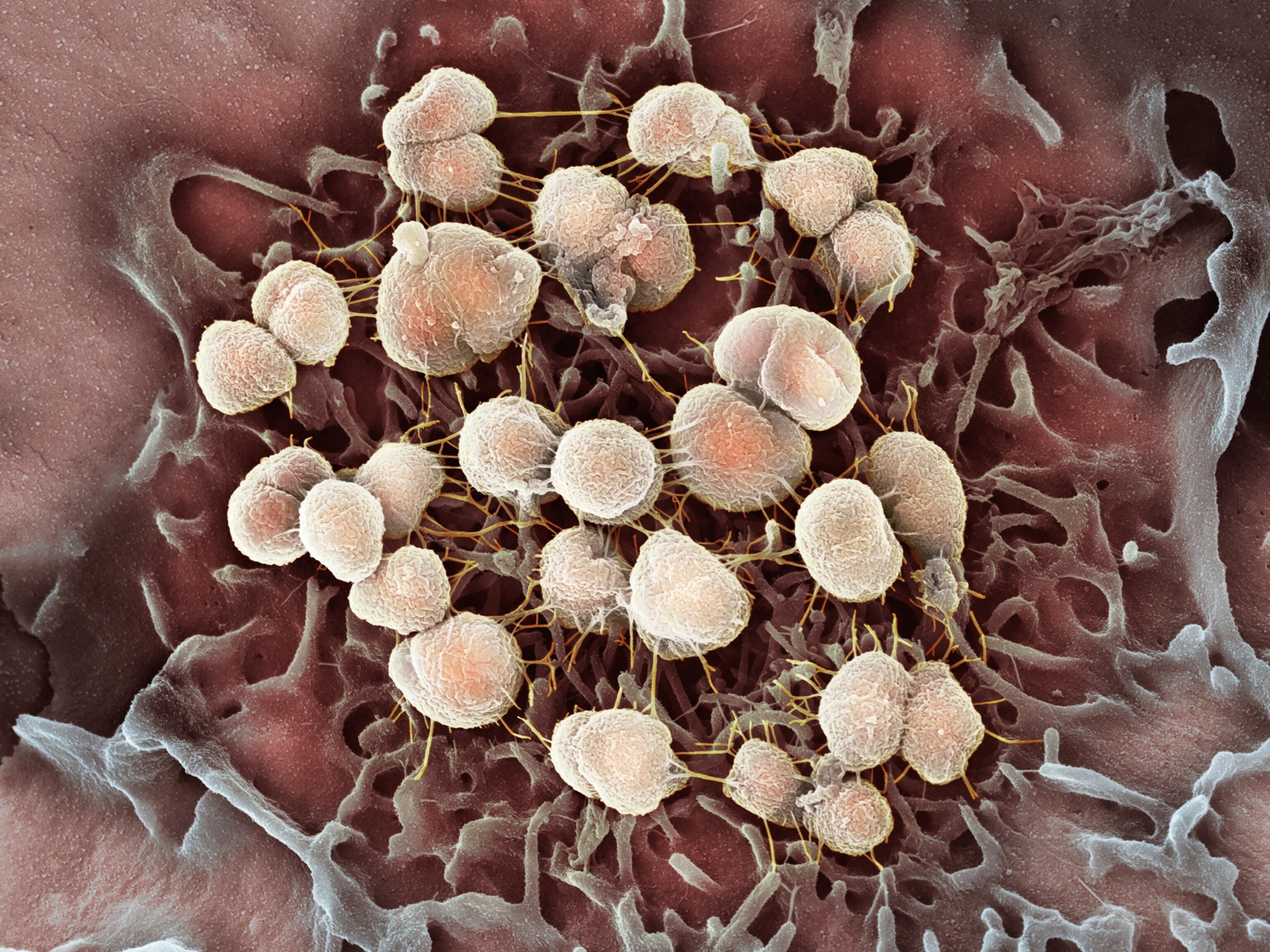 STDs are at a shocking high. How do we reverse the trend?