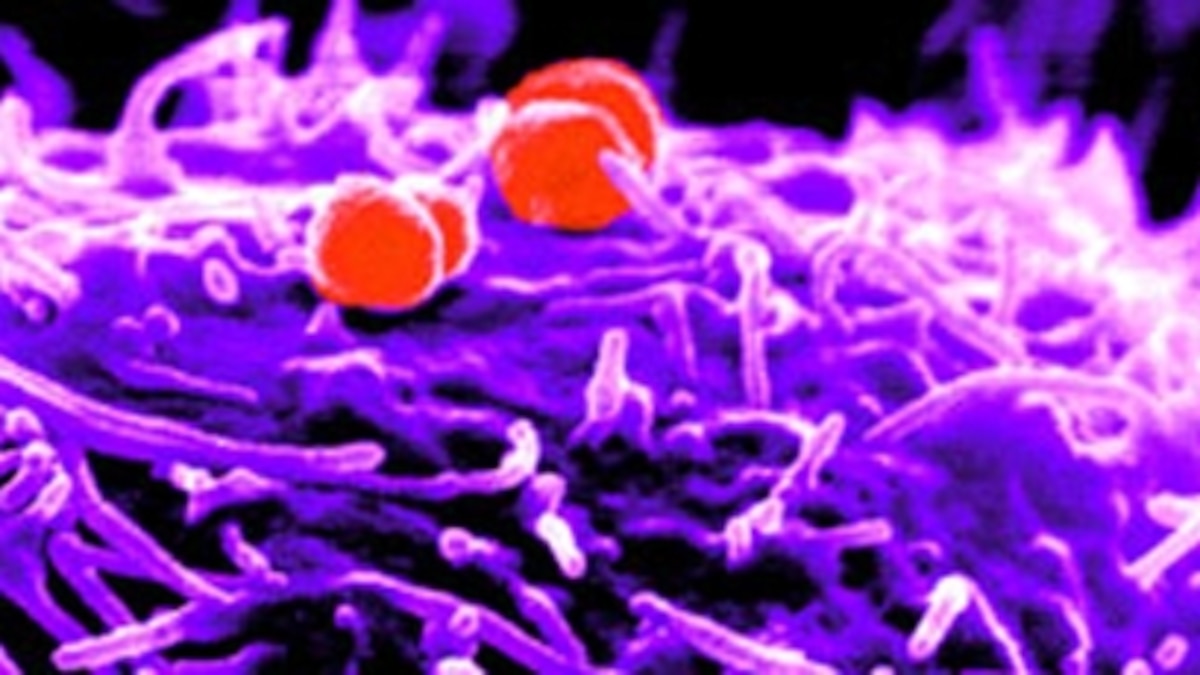 Gonorrhea has picked up human DNA (and that’s just the beginning ...