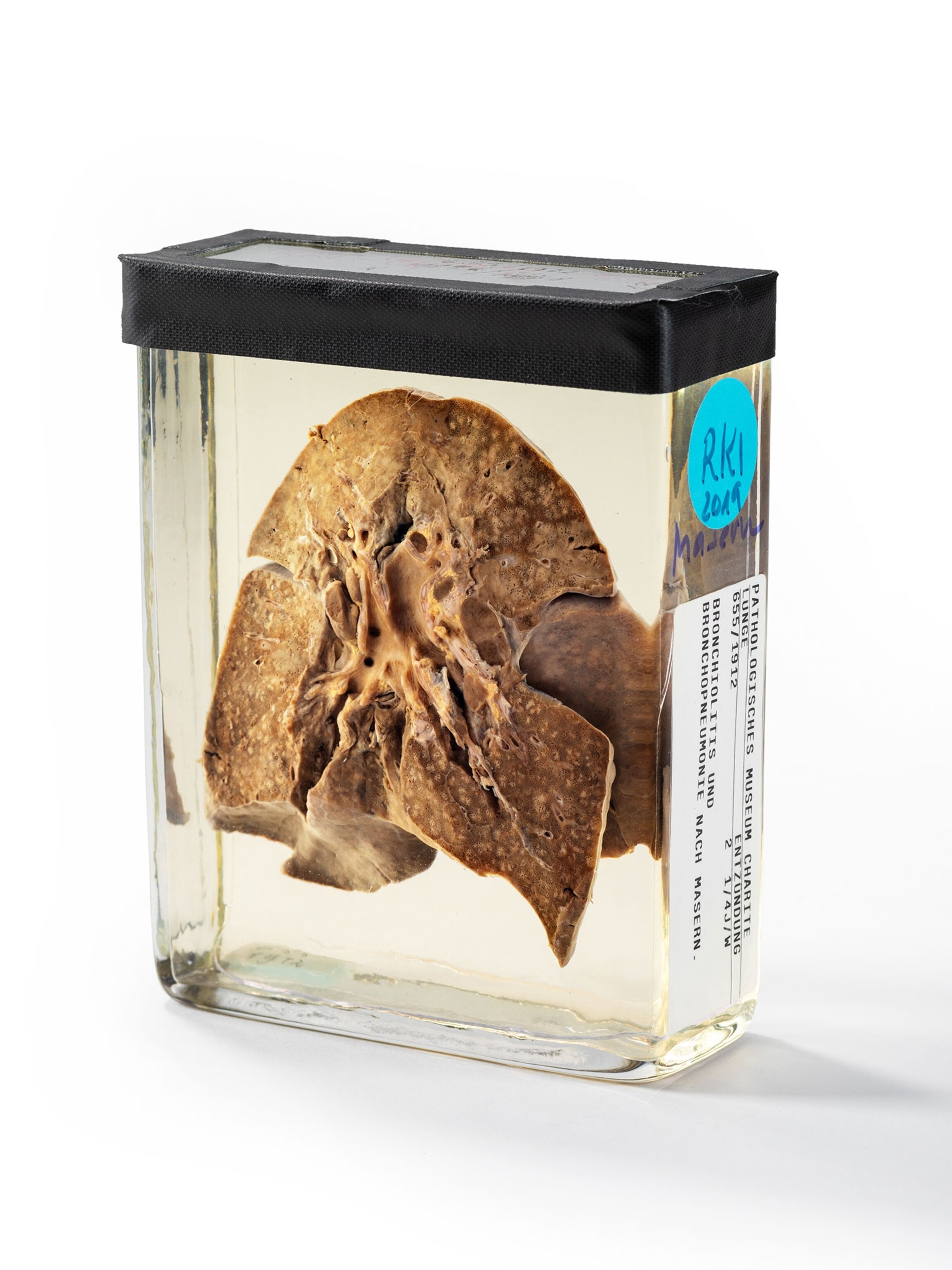 How viruses shape our world