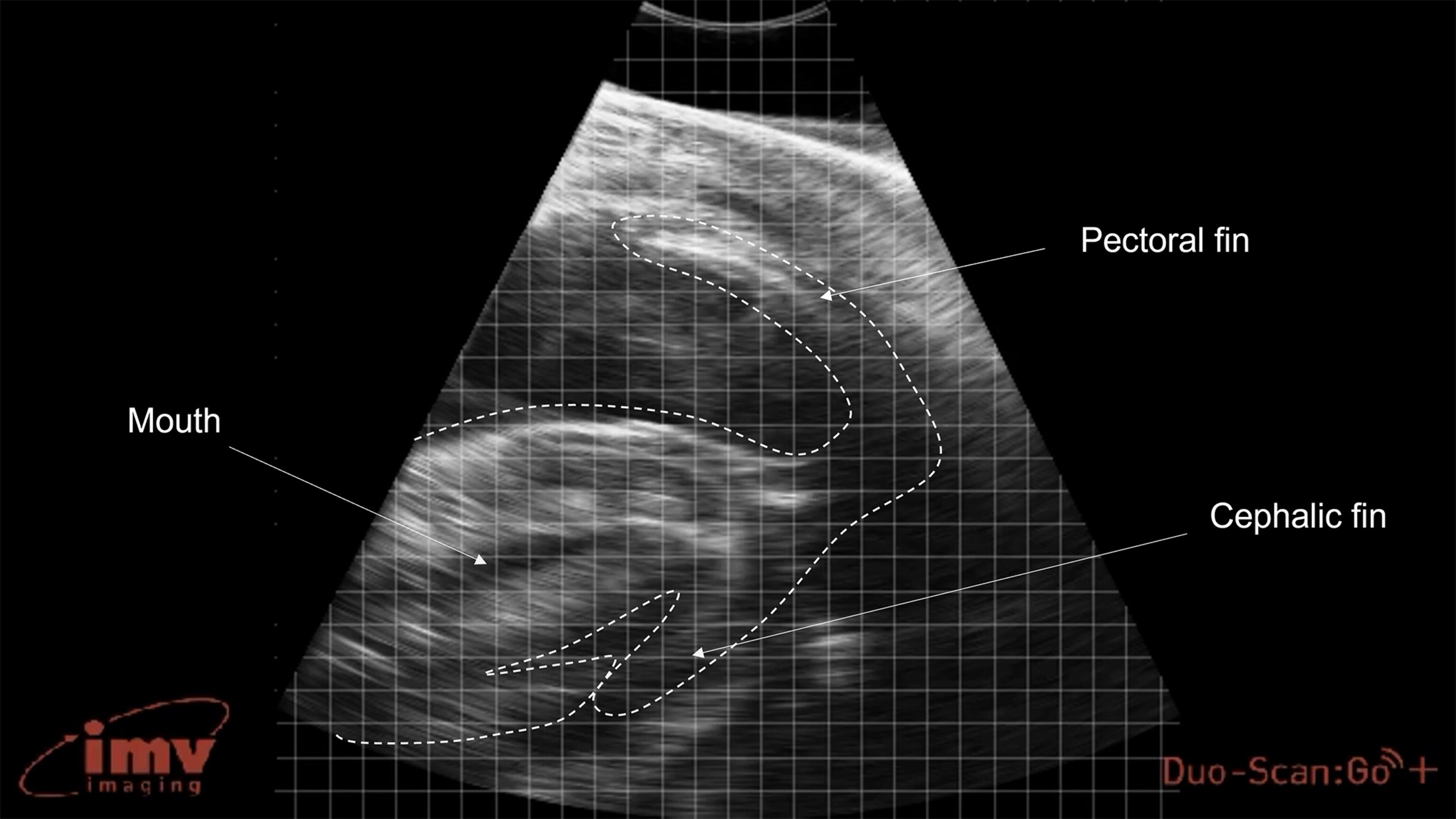 The world’s first ultrasounds of wild manta rays reveal a troubling truth