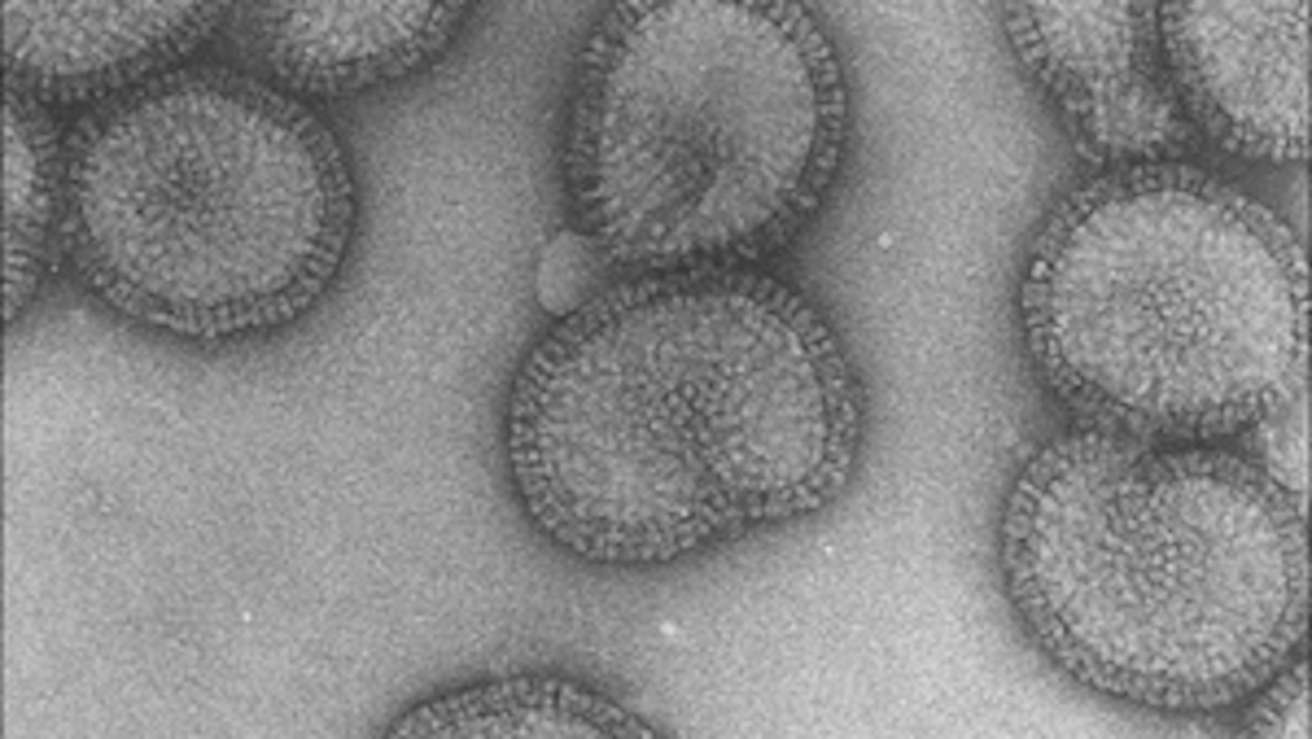 Bird Flu: Any Information to Declare? | National Geographic