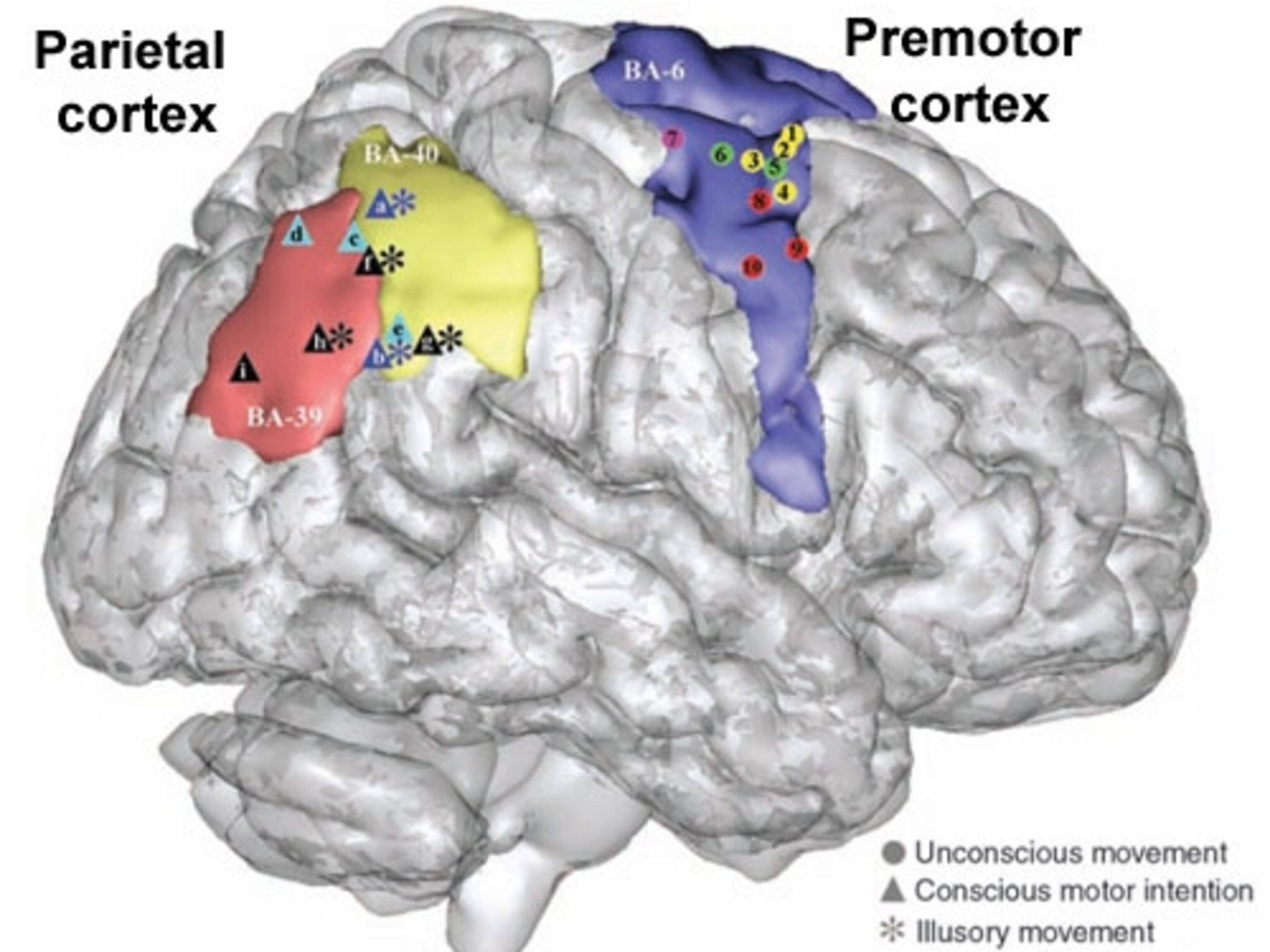 Electrical stimulation produces feelings of free will