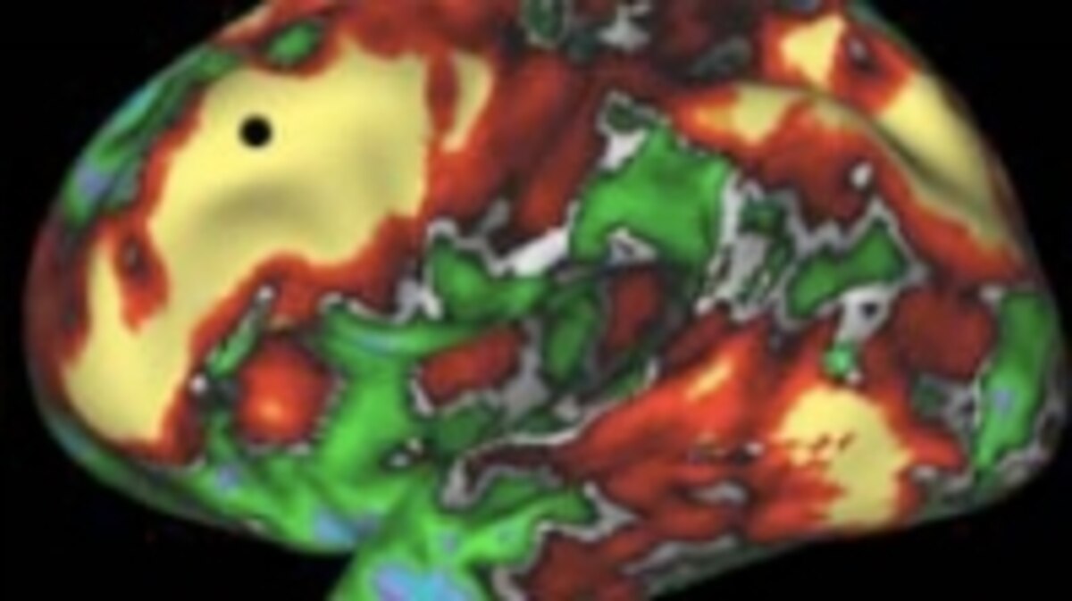 The Brain’s Dark Energy | National Geographic