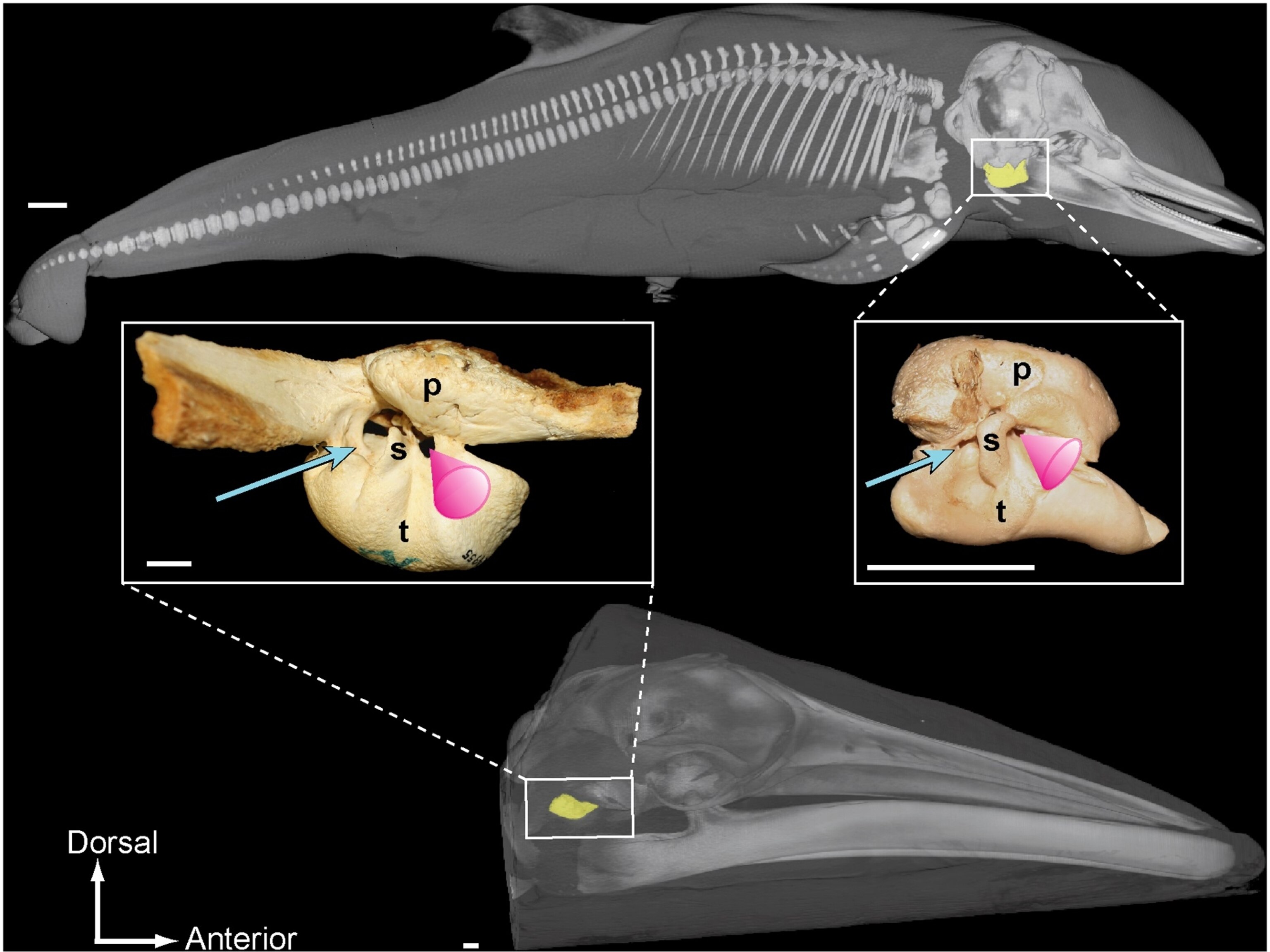 Acoustic Fats, Ear Trumpets, and How Whales Hear