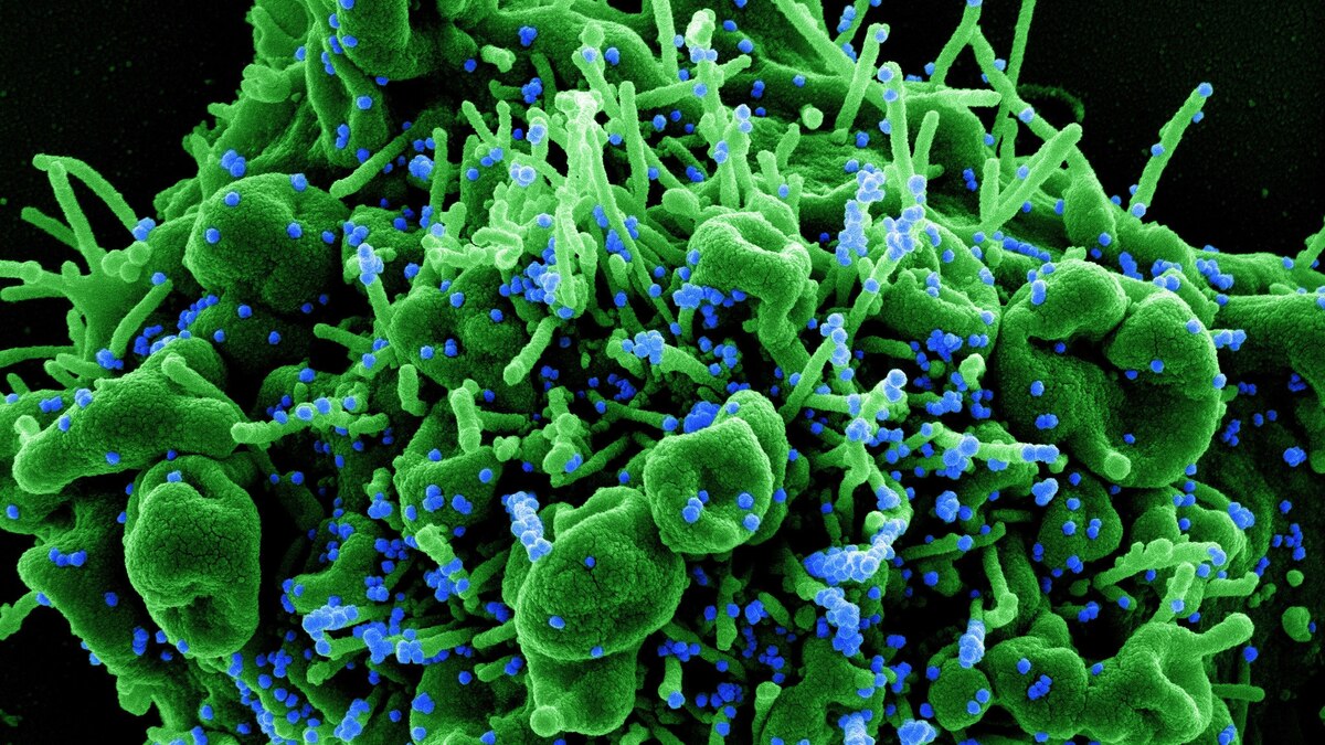 Why some coronavirus variants are more contagious—and how we can stop ...