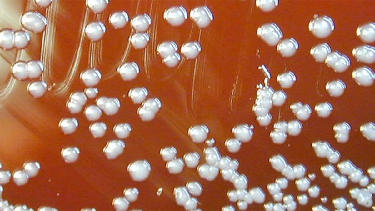 Scientists track the evolution of an epidemic to show how bacteria ...