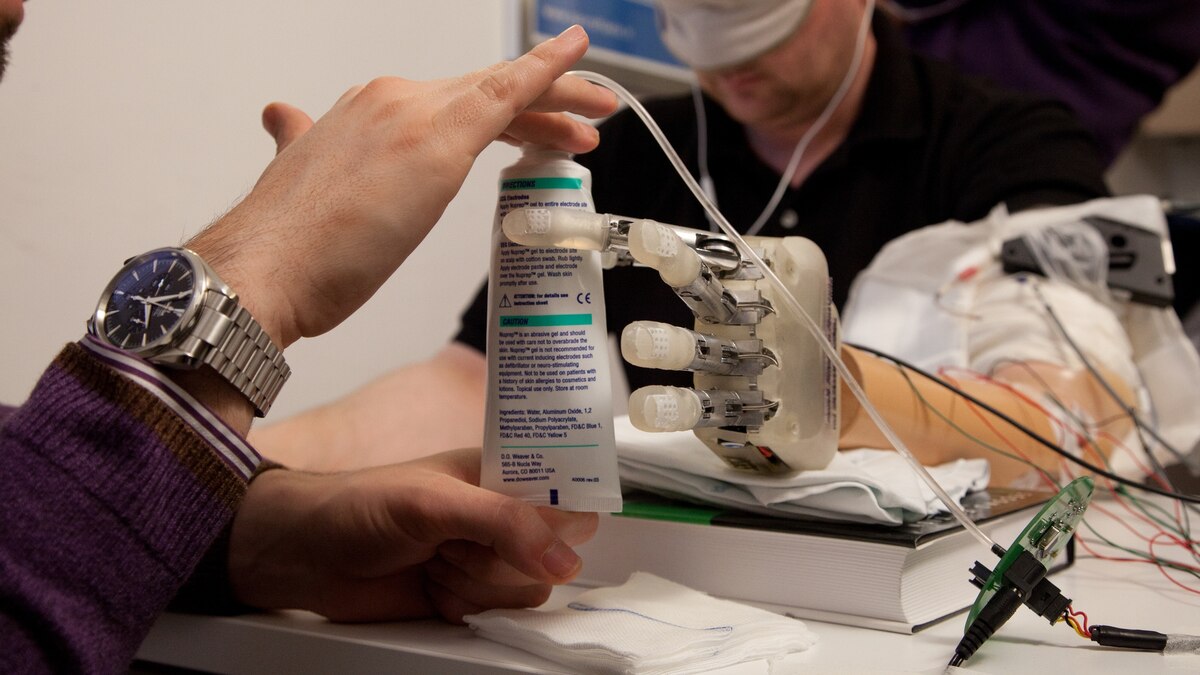 Revolution in Artificial Limbs Brings Feeling Back to Amputees ...