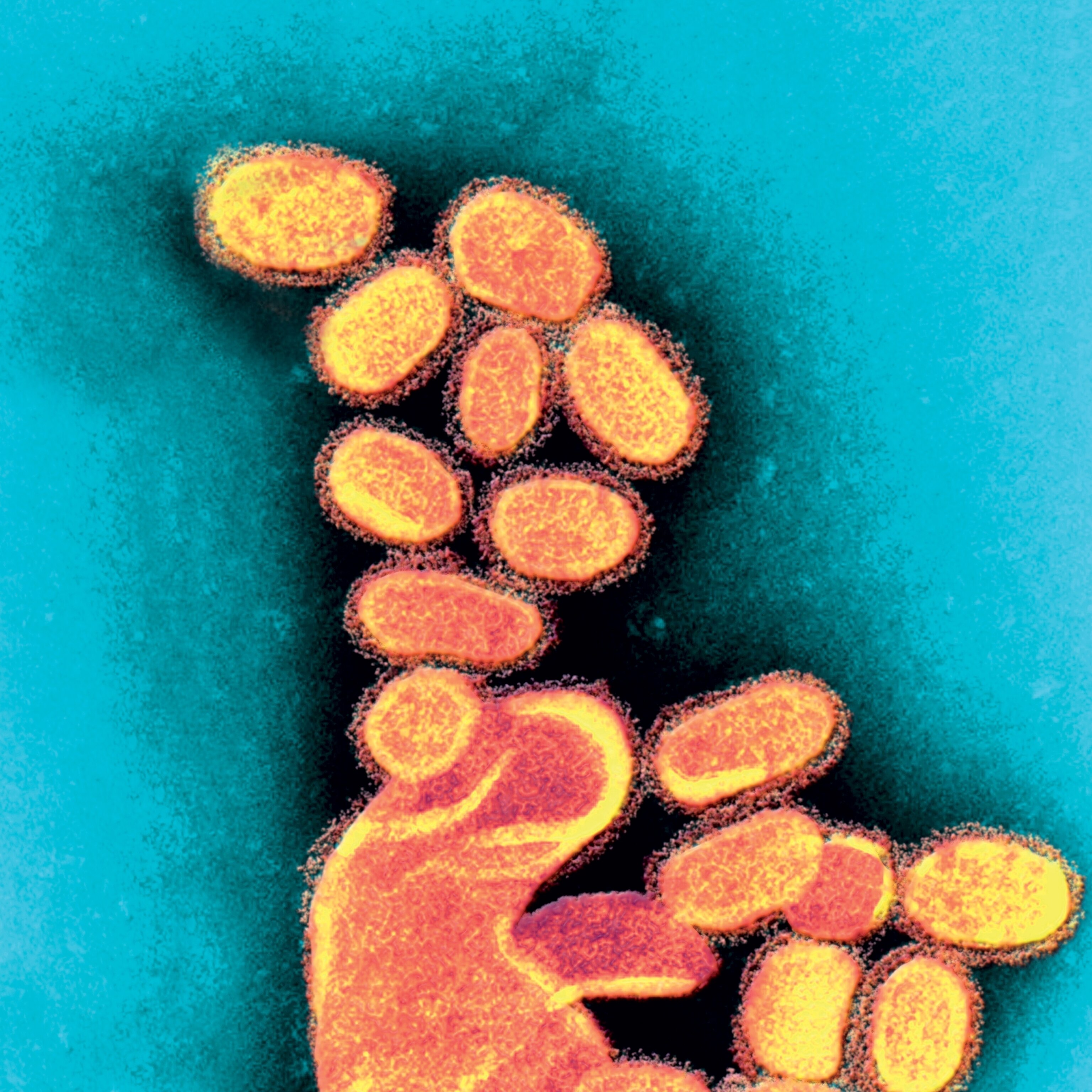 Inside the Swift, Deadly History of the Spanish Flu Pandemic