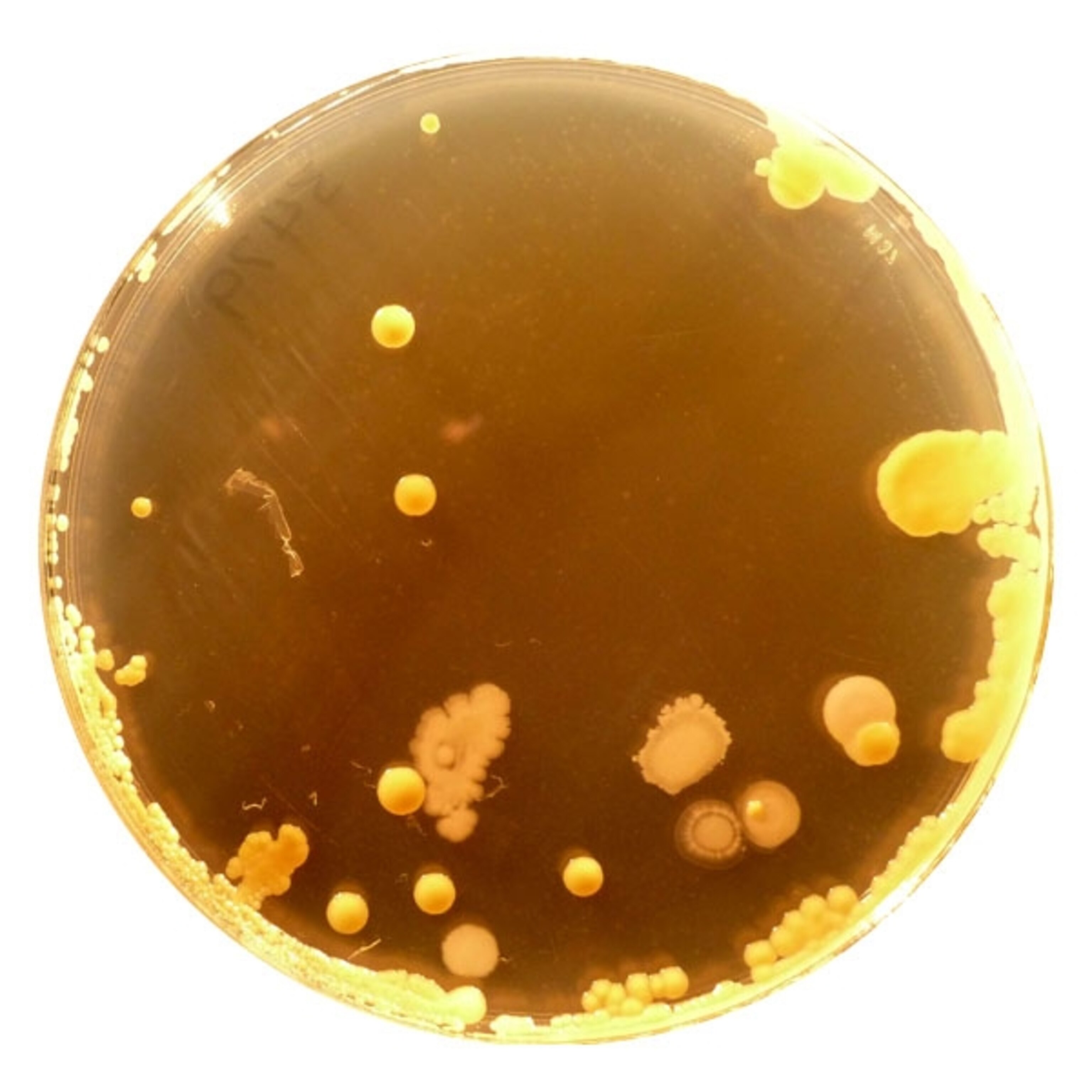 The ultimate case of TMI: Behold my bellybutton's microbiome | National ...