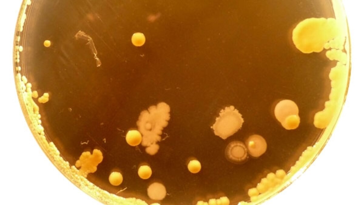 The ultimate case of TMI: Behold my bellybutton's microbiome | National ...