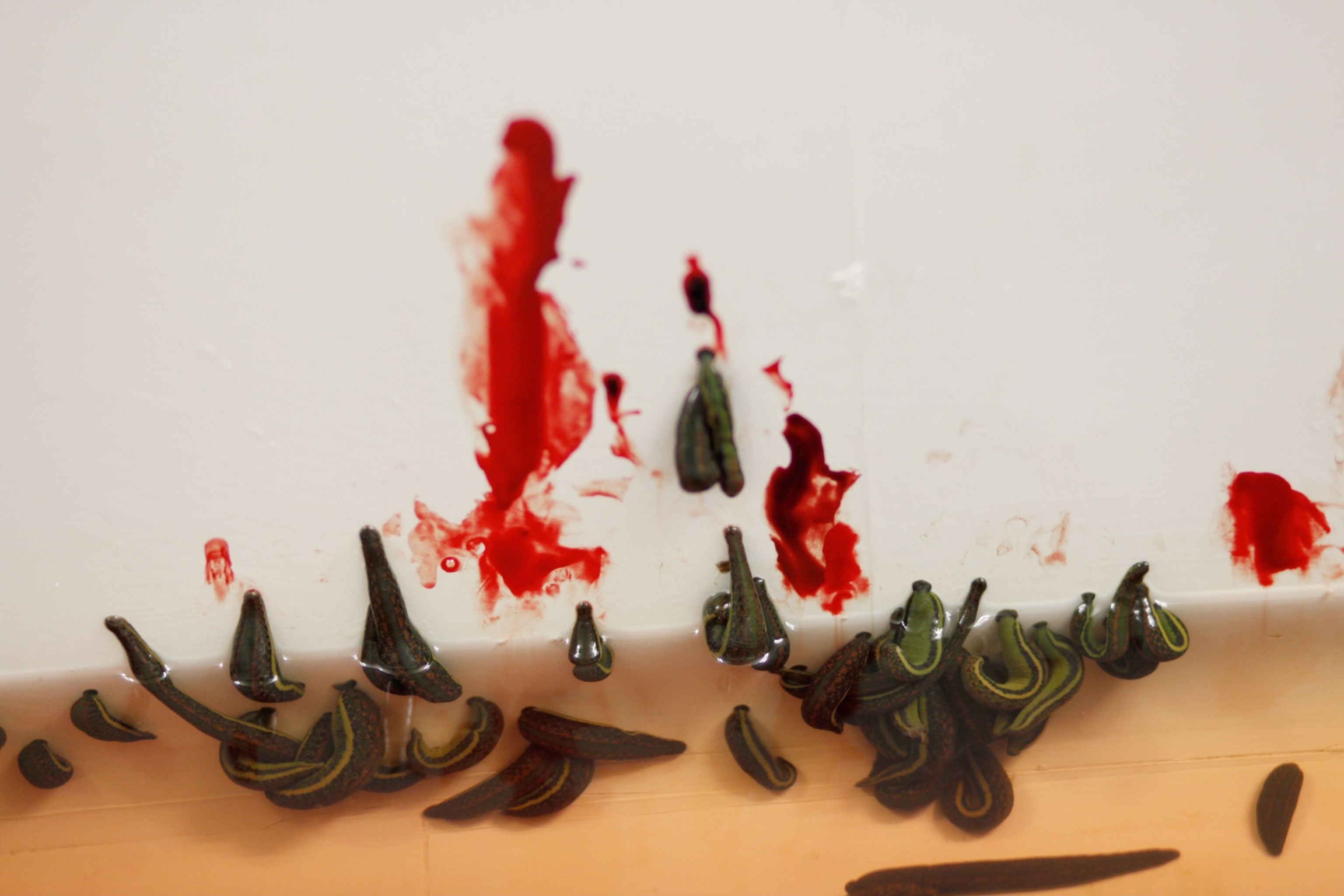 Leeches are still used in medicine—yes, really. Here’s why.