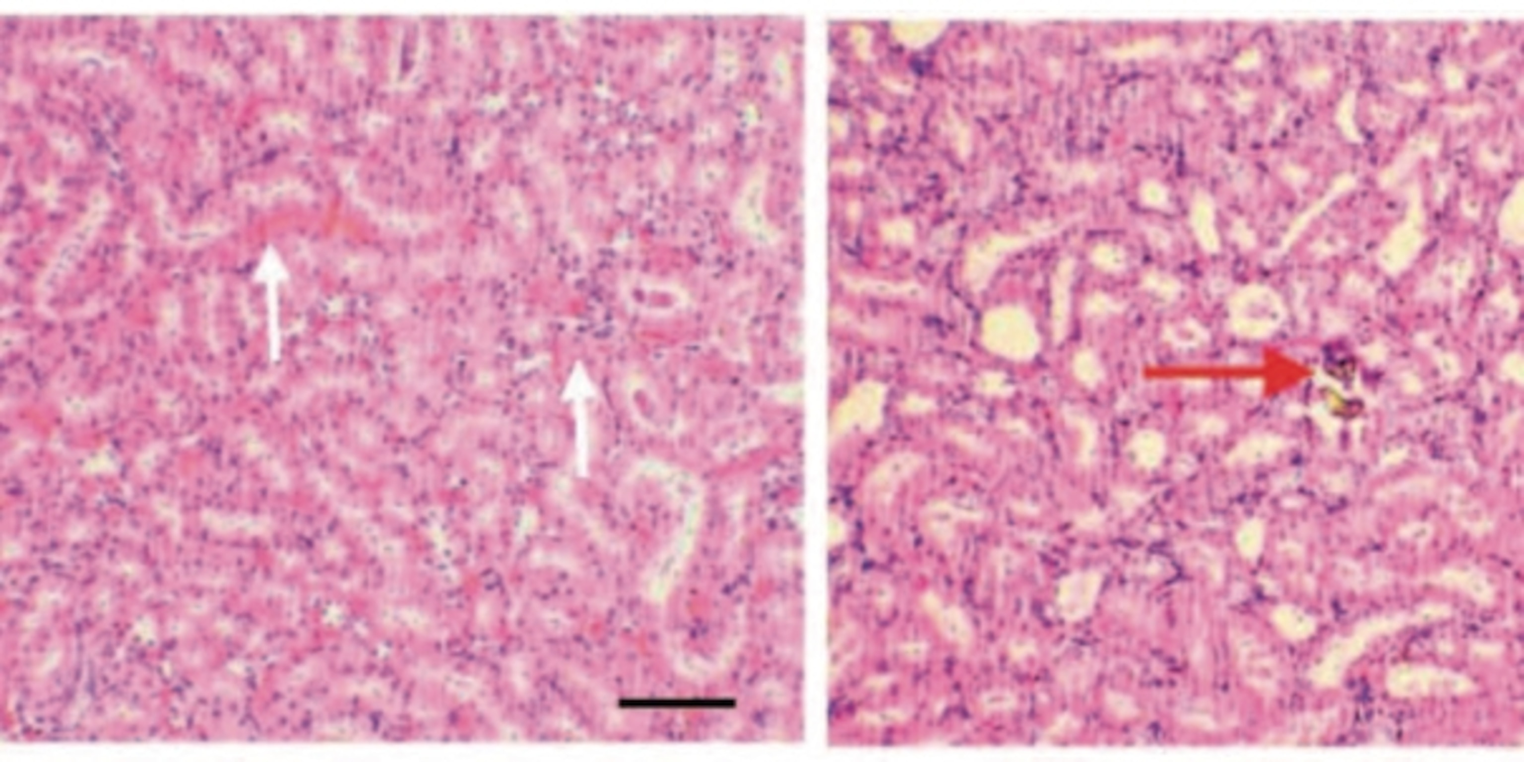 A New Culprit in China’s Tainted Milk Saga: Gut Bacteria