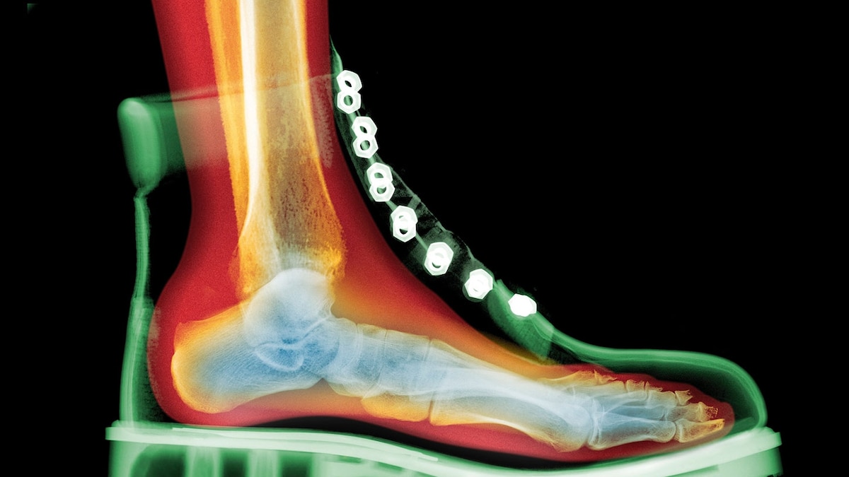 This is what happens to your body if your shoes don’t fit right ...