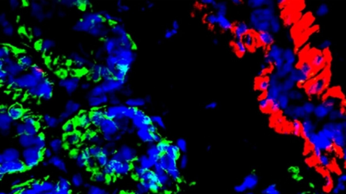 Breast cells naturally transform into stem cells